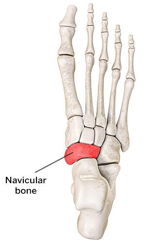 Accessory Navicular Problems - ArthurCare