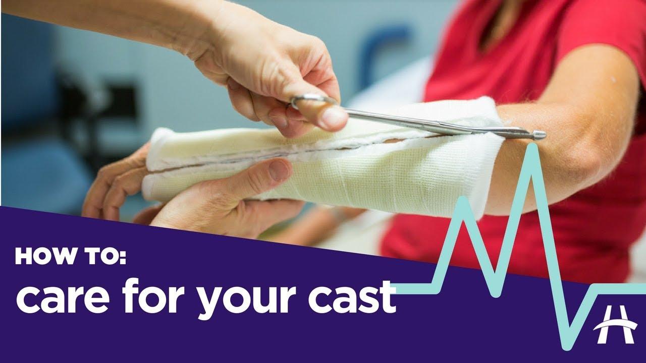 Cast Care - ArthurCare